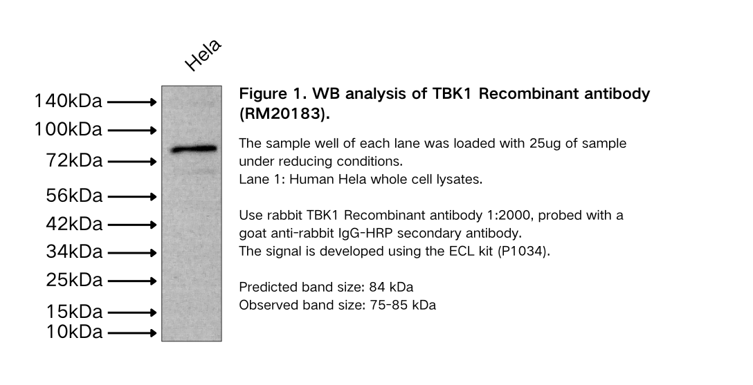 TBK1 Recombinant antibody - 天涯生物